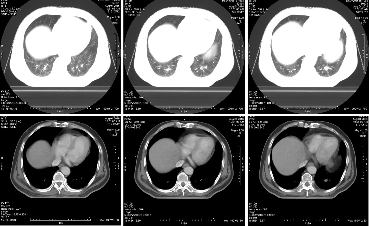 RT微课堂：心意随形，形随心动--帖子详情