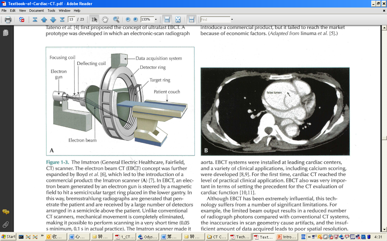 冠脉CT的发展--帖子详情