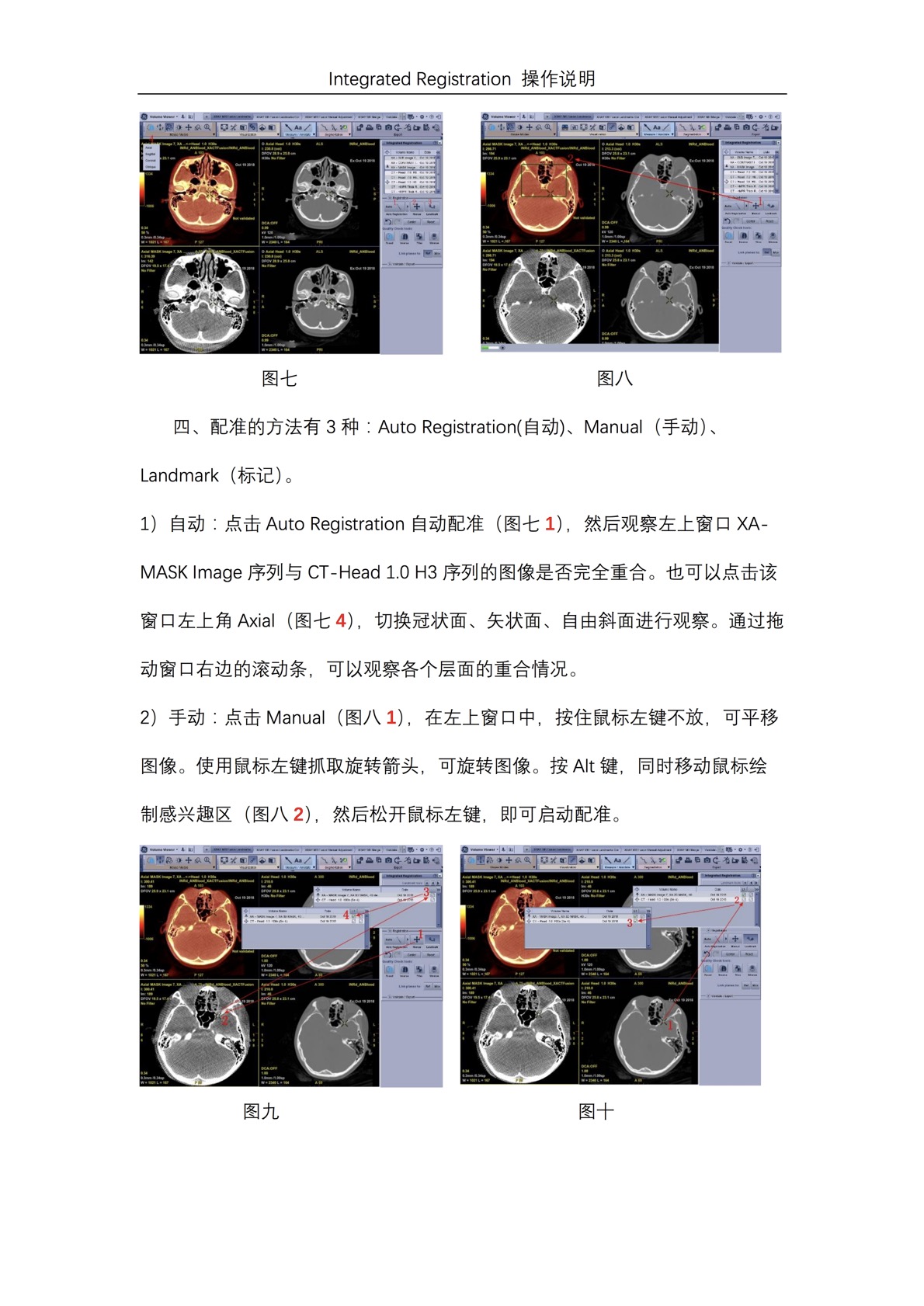 AW4.7 Integrated Registration操作说明--帖子详情