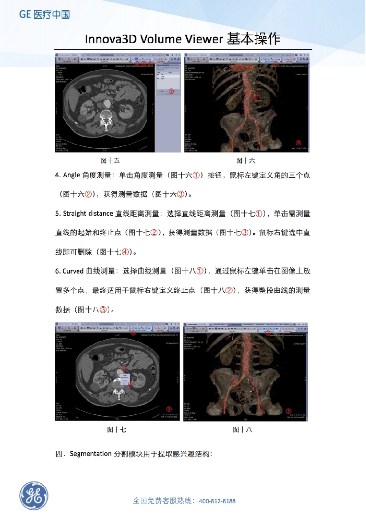 AW4.7 Volume Viewer基本操作--帖子详情